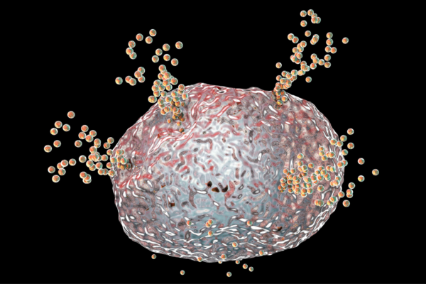 Mast Cell Activation Syndrome: How It's Diagnosed and 2 Exciting New ...