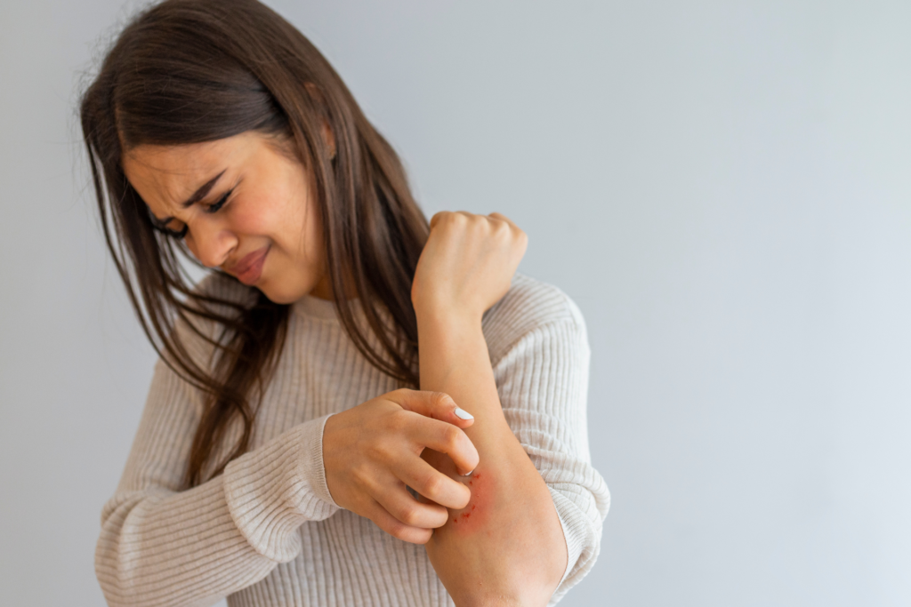 What Really Causes Eczema? And Can It Be Healed Naturally? | Dr. Jill ...
